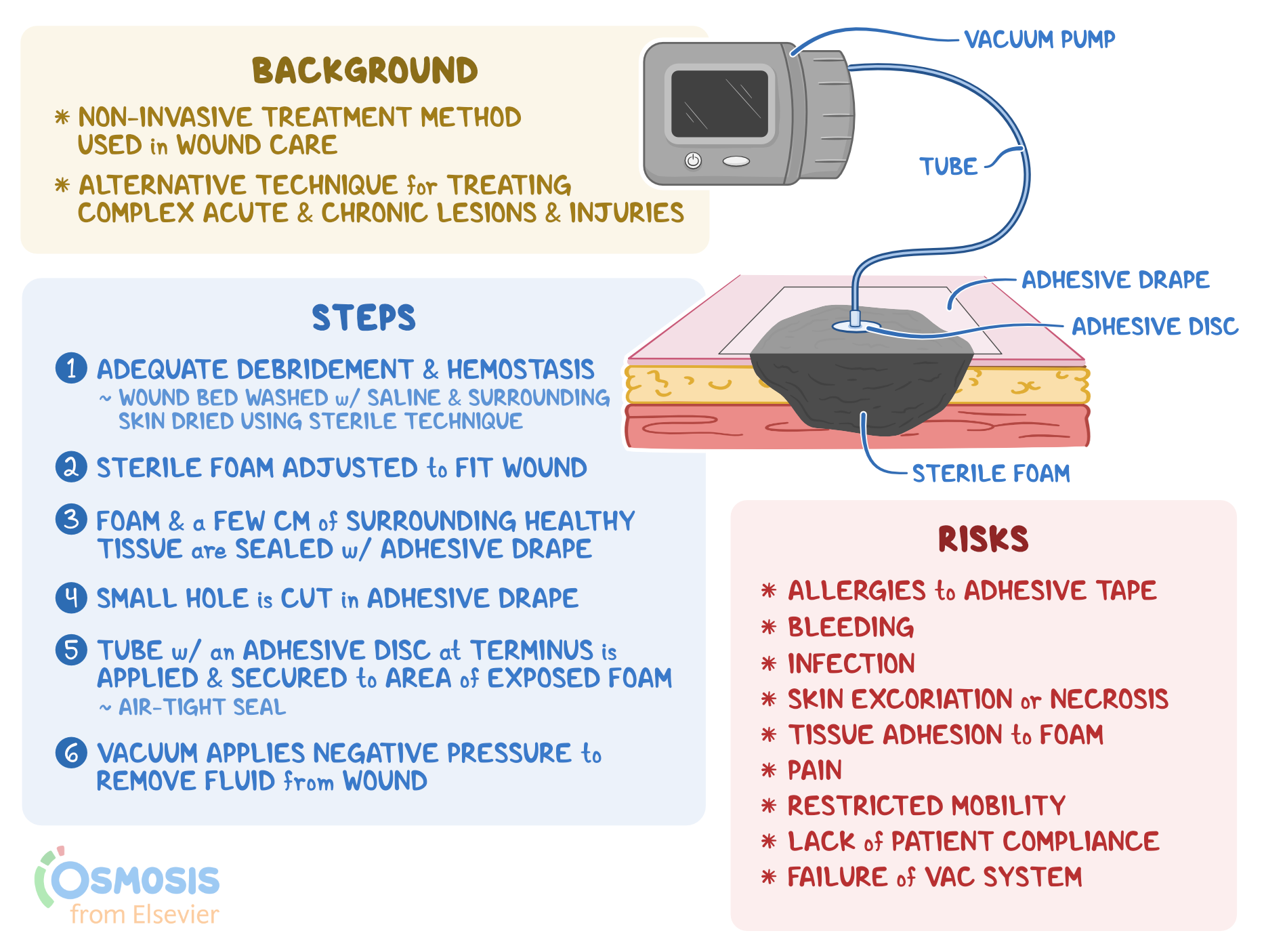 Wound Vacuum-assisted Closure (VAC) Therapy: What Is It, How It Works ...