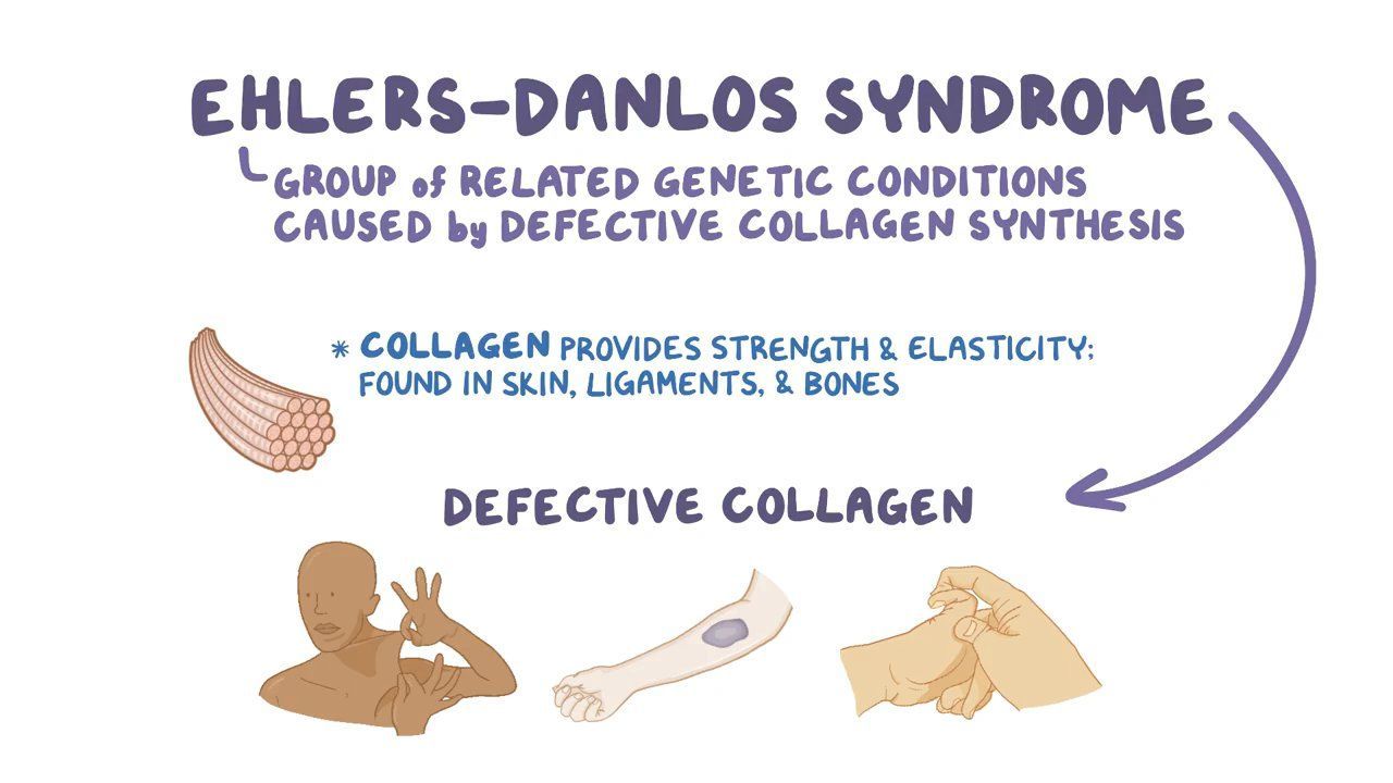 Ehlers Danlos National Foundation