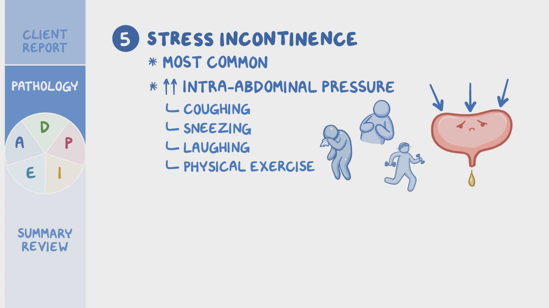 Video: Urinary incontinence - Stress: Nursing process (ADPIE) | Osmosis