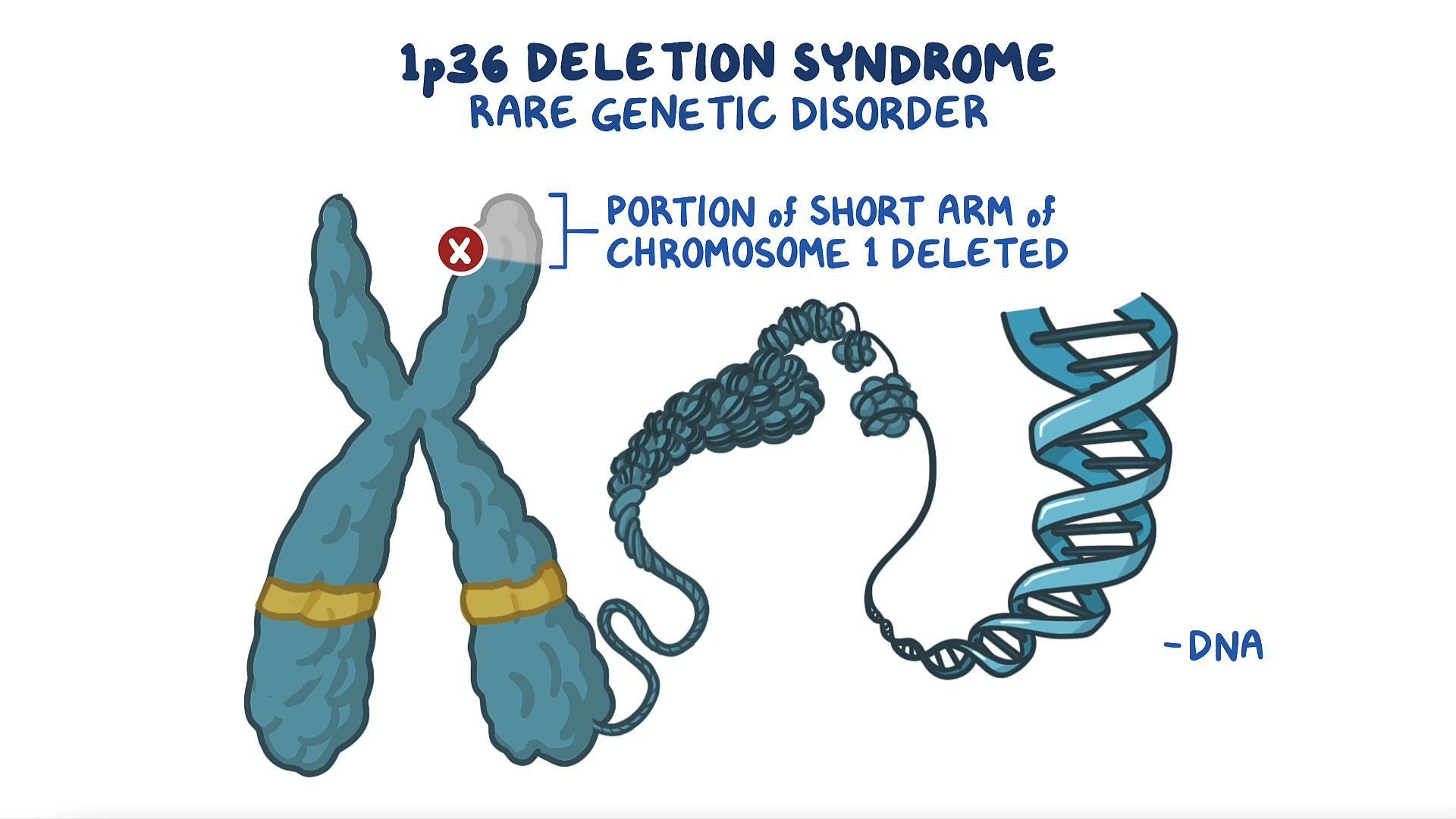 Video: 1p36 deletion syndrome: Year of the Zebra