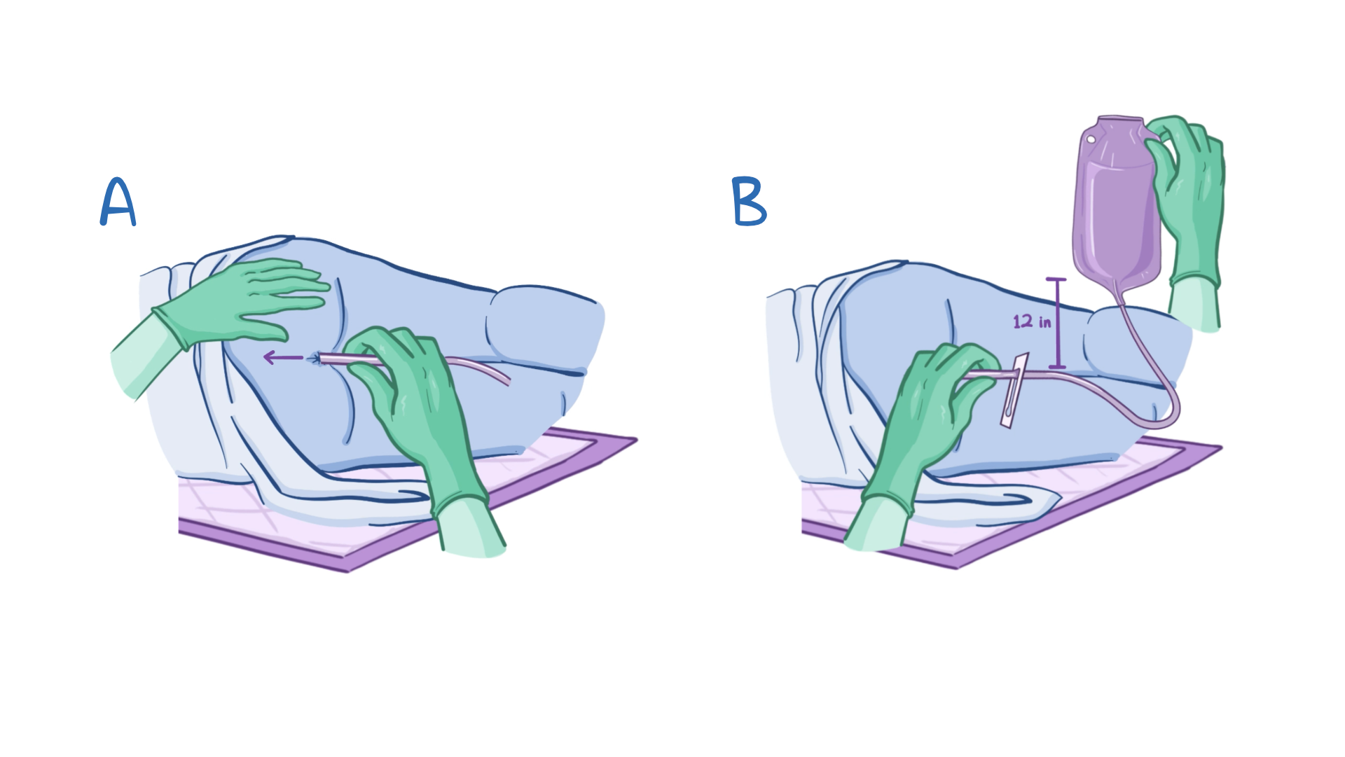 Enema Procedure Enema Procedure