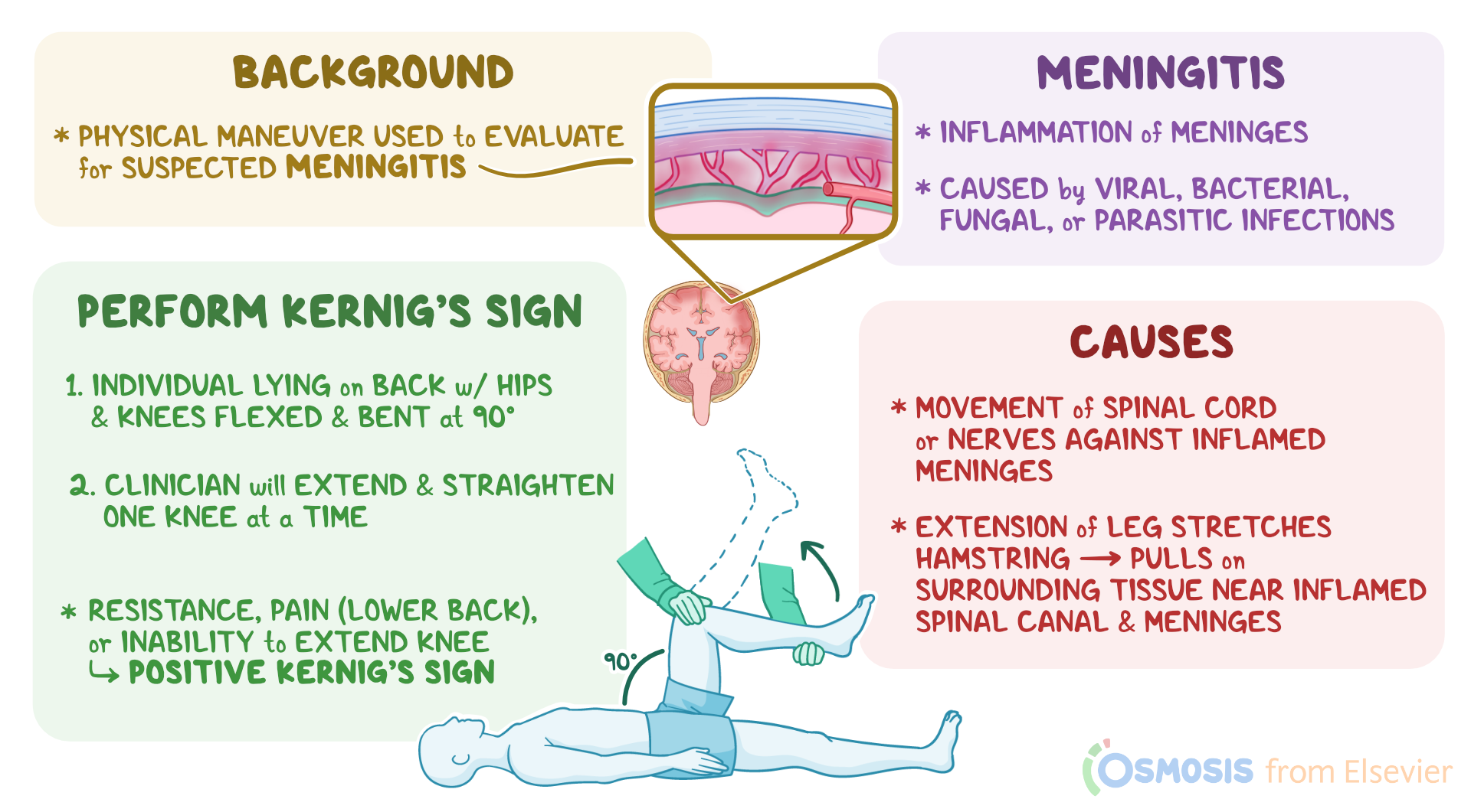 Kernig Sign: What Is It, How It?s Used, and More | Osmosis