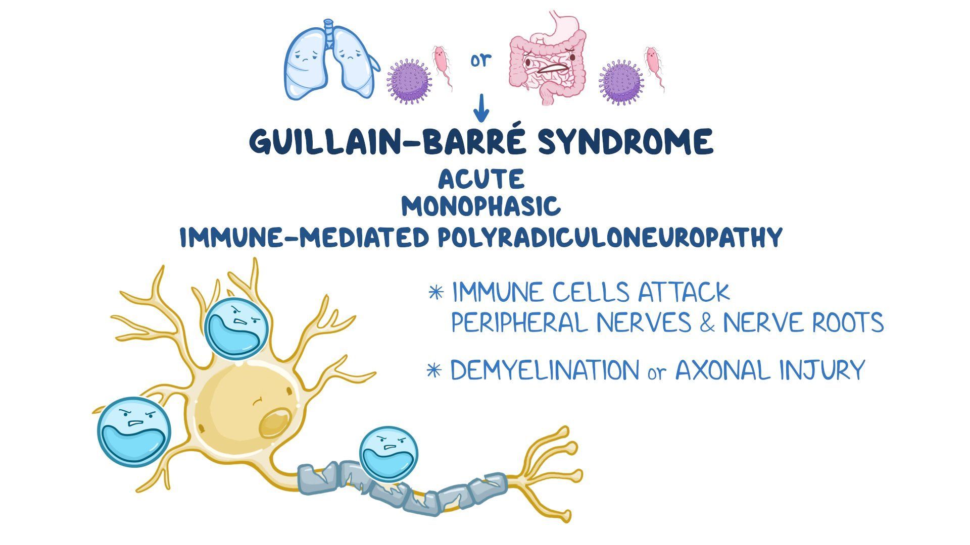 Video: Guillain-Barré syndrome: Clinical sciences | Osmosis