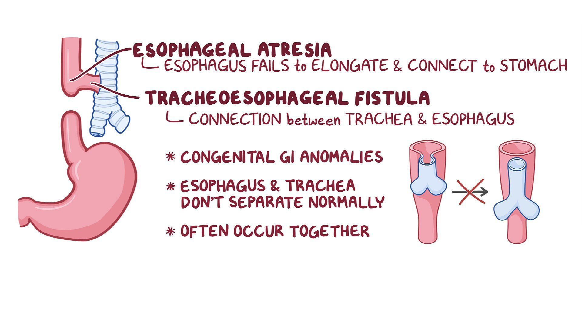 Proximal Vs Distal Esophagus