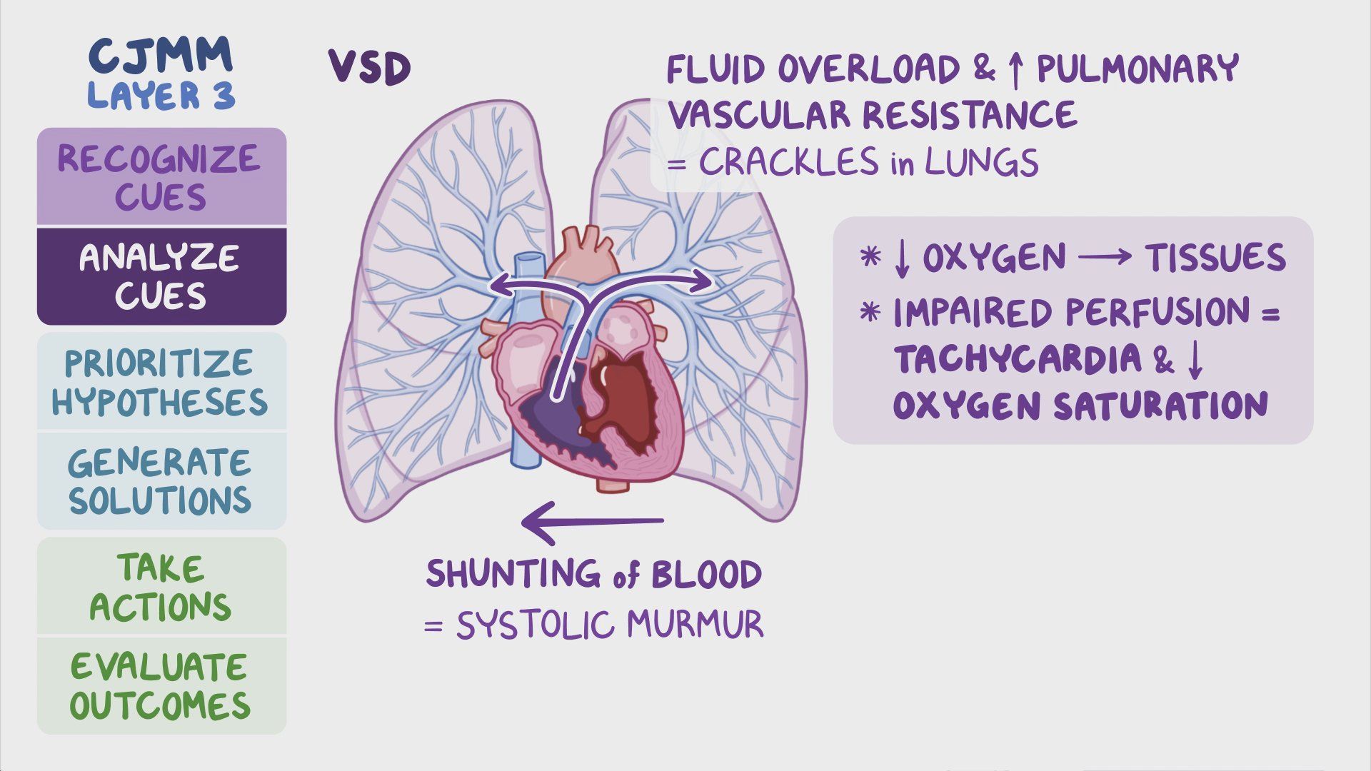 Video: Case study - Ventricular septal defect (VSD): Nursing | Osmosis