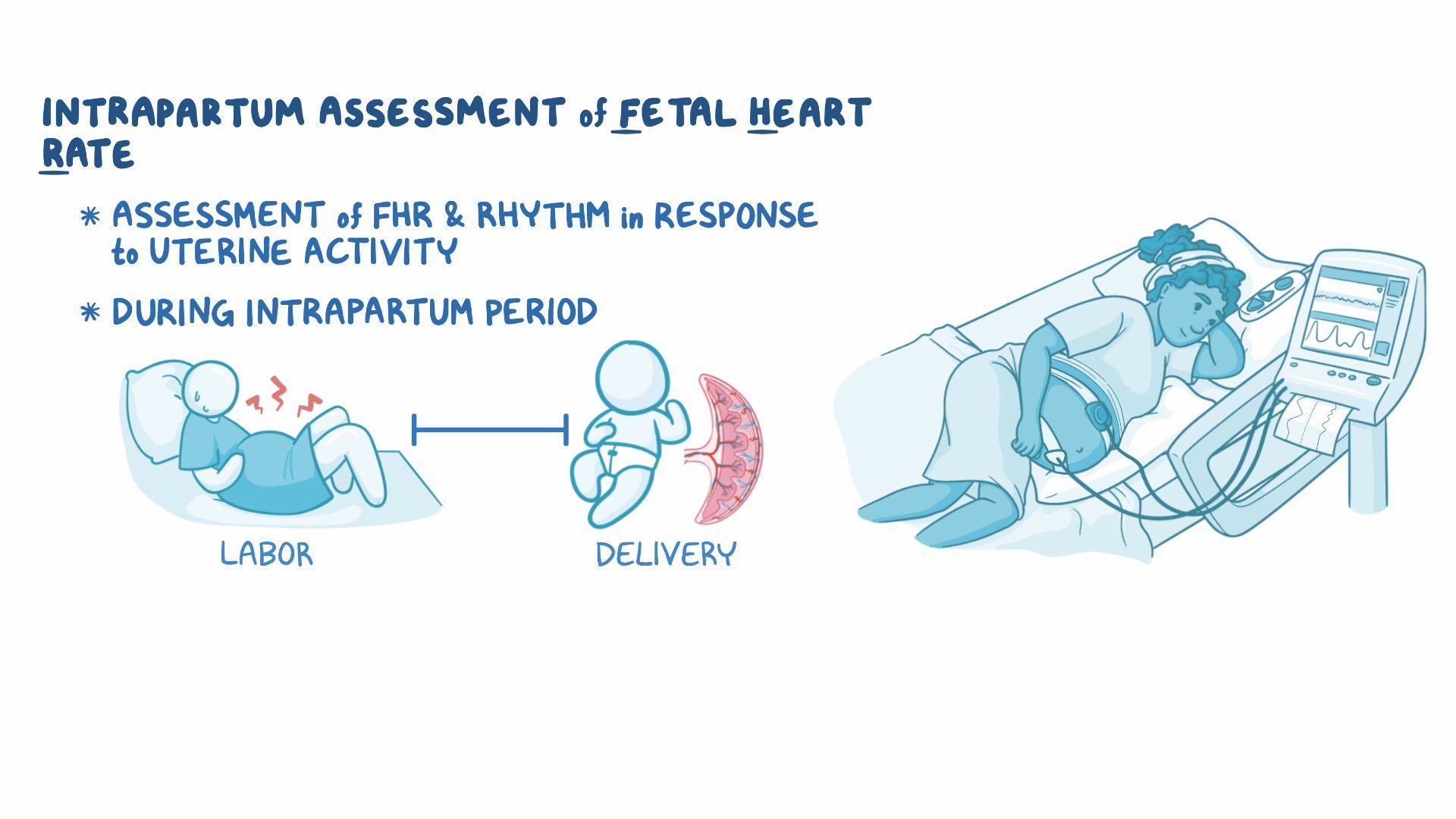 Video: Intrapartum assessment - Fetal heart rate patterns: Nursing ...