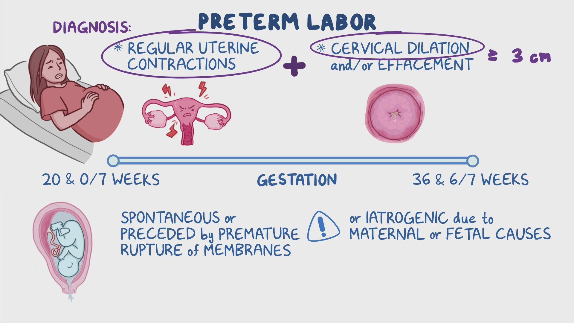 Video Preterm Labor Clinical Sciences Osmosis