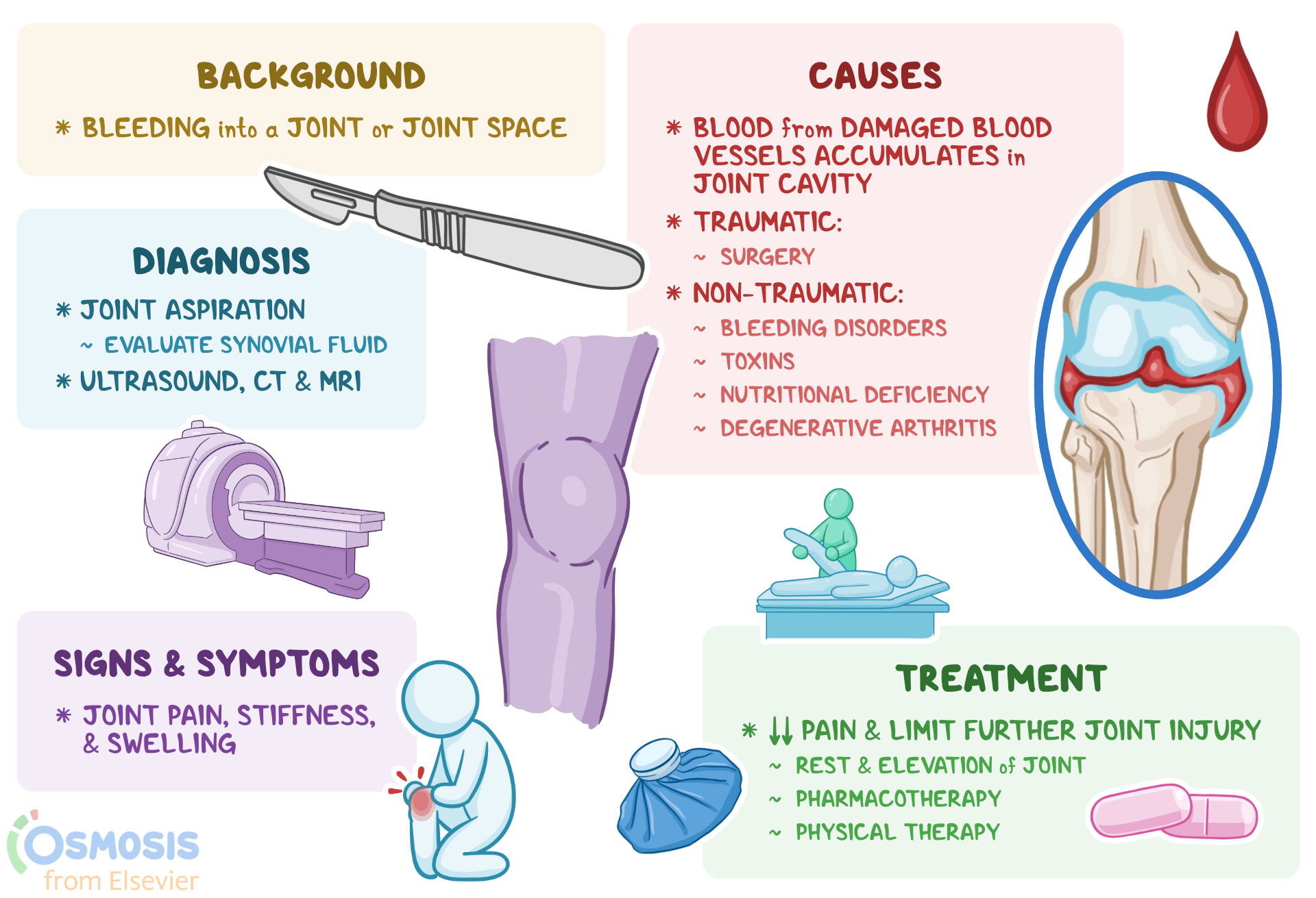 Joint Effusion Treatment Knee Effusion Synovitis Volume Measurement