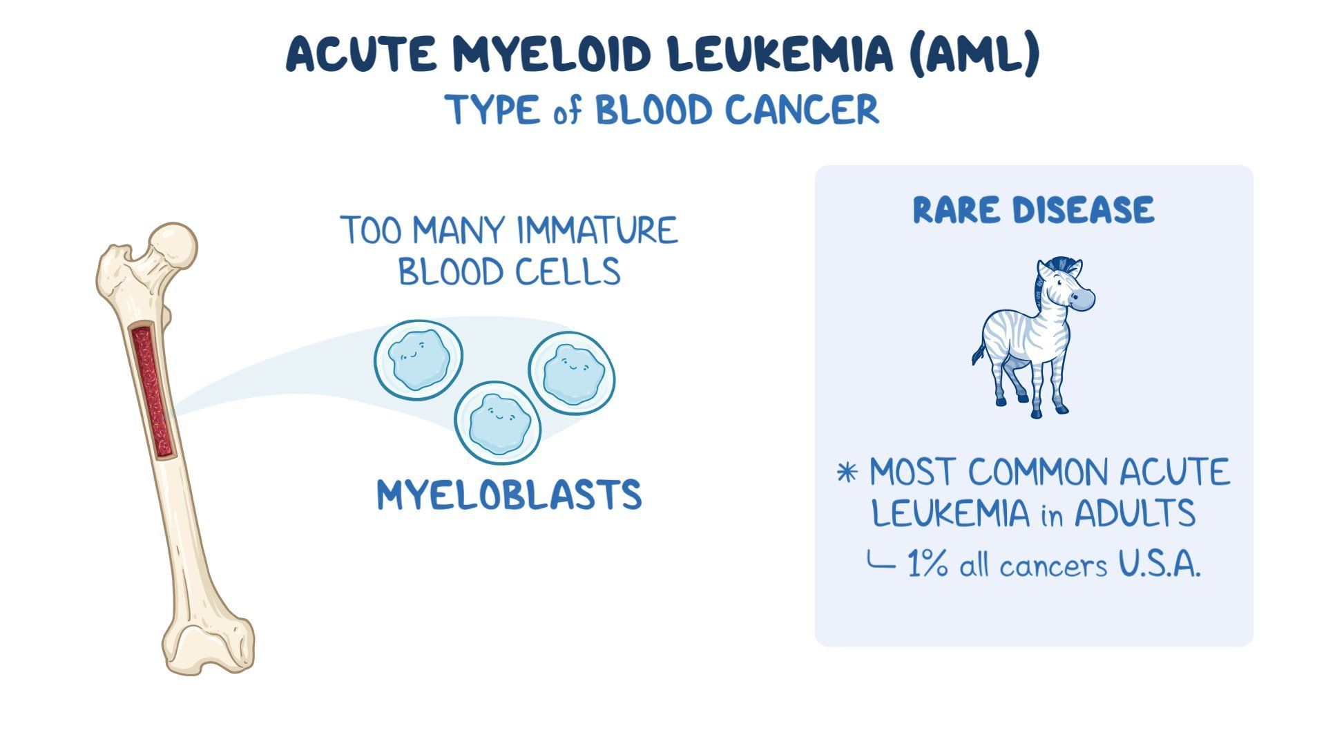 Video: Acute myeloid leukemia (AML): Year of the Zebra 2026 | Osmosis