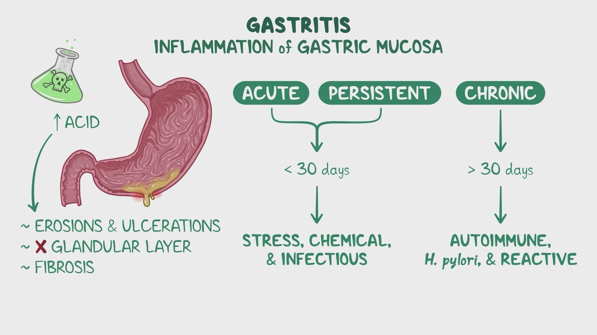 Video Gastritis Clinical Sciences Osmosis