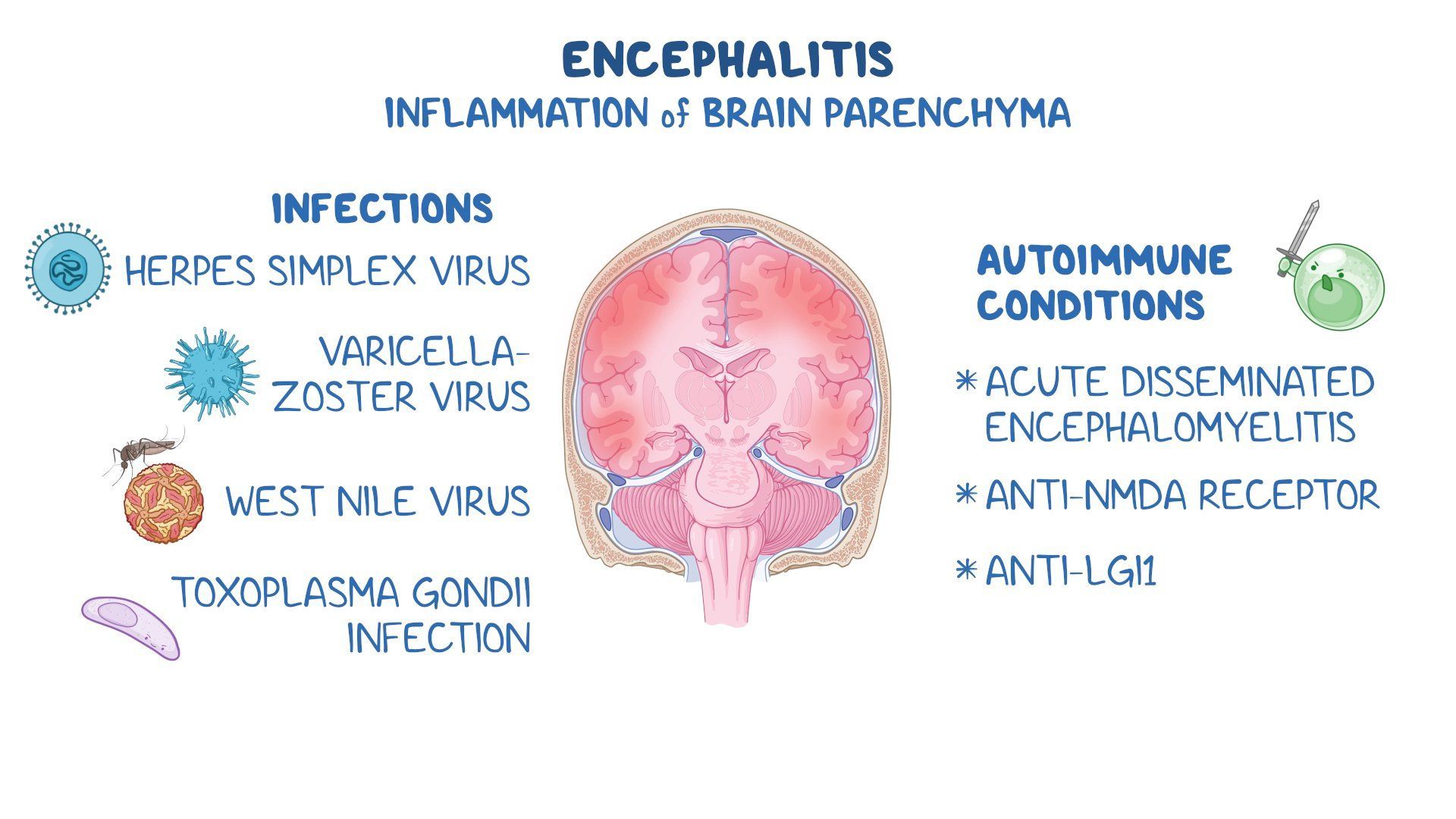 Video Approach To Encephalitis Clinical Sciences Osmosis
