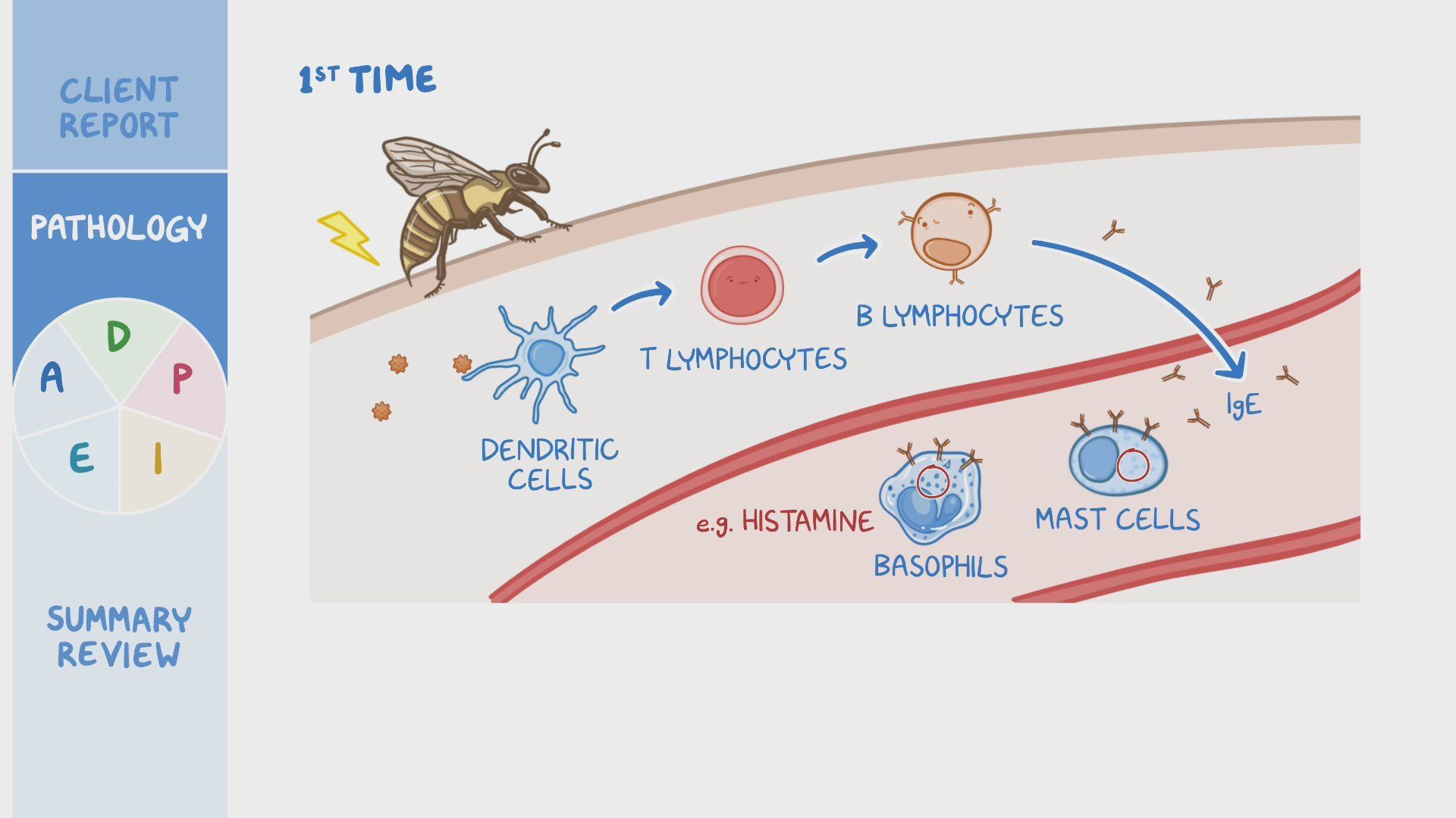 Video: Anaphylaxis: Nursing process (ADPIE) | Osmosis