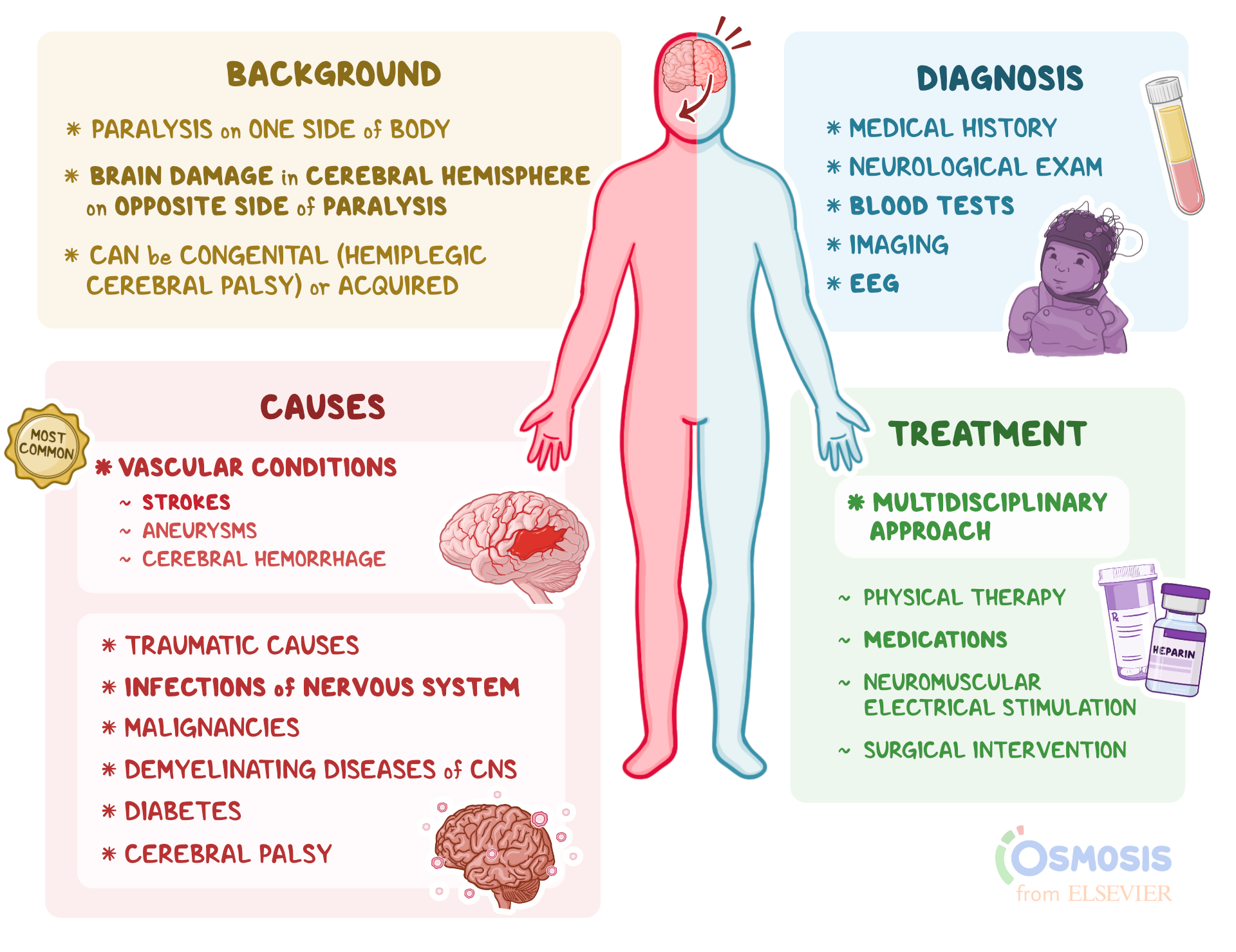 Hemiplegia Definition Causes Symptoms Treatment 57 OFF Hemiplegia Definition Causes Symptoms Treatment 57 OFF