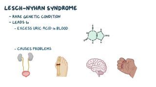 Purine and pyrimidine metabolism disorders Notes: Diagrams ...