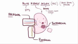 Acute And Chronic Kidney Disease Notes Diagrams Illustrations Osmosis
