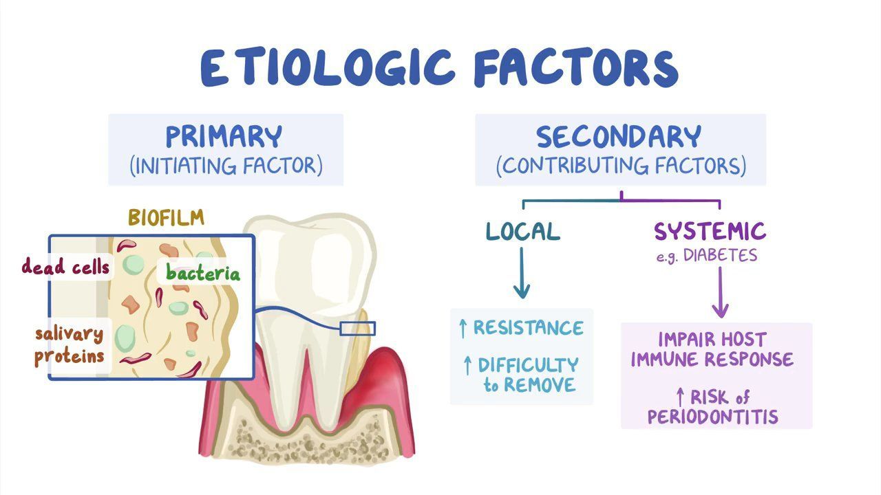 Risk Factors for Periodontitis - Osmosis