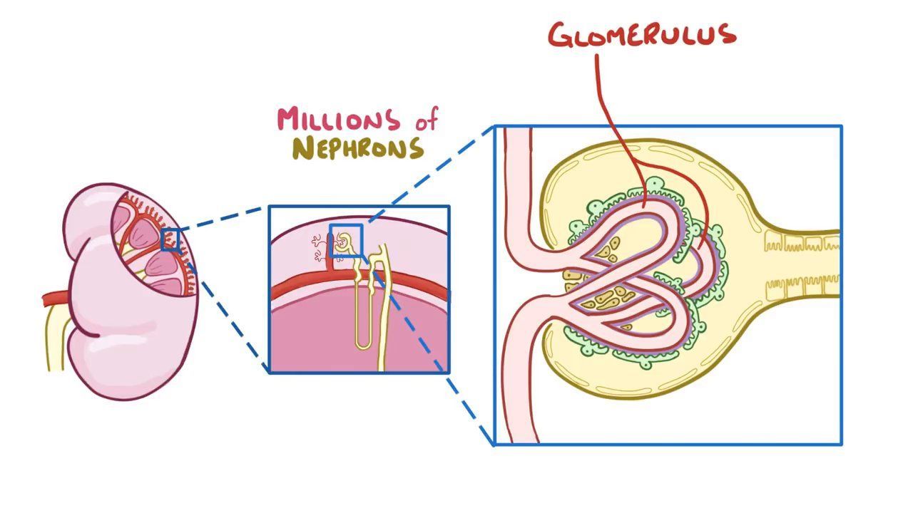 Video: Diabetic nephropathy | Osmosis