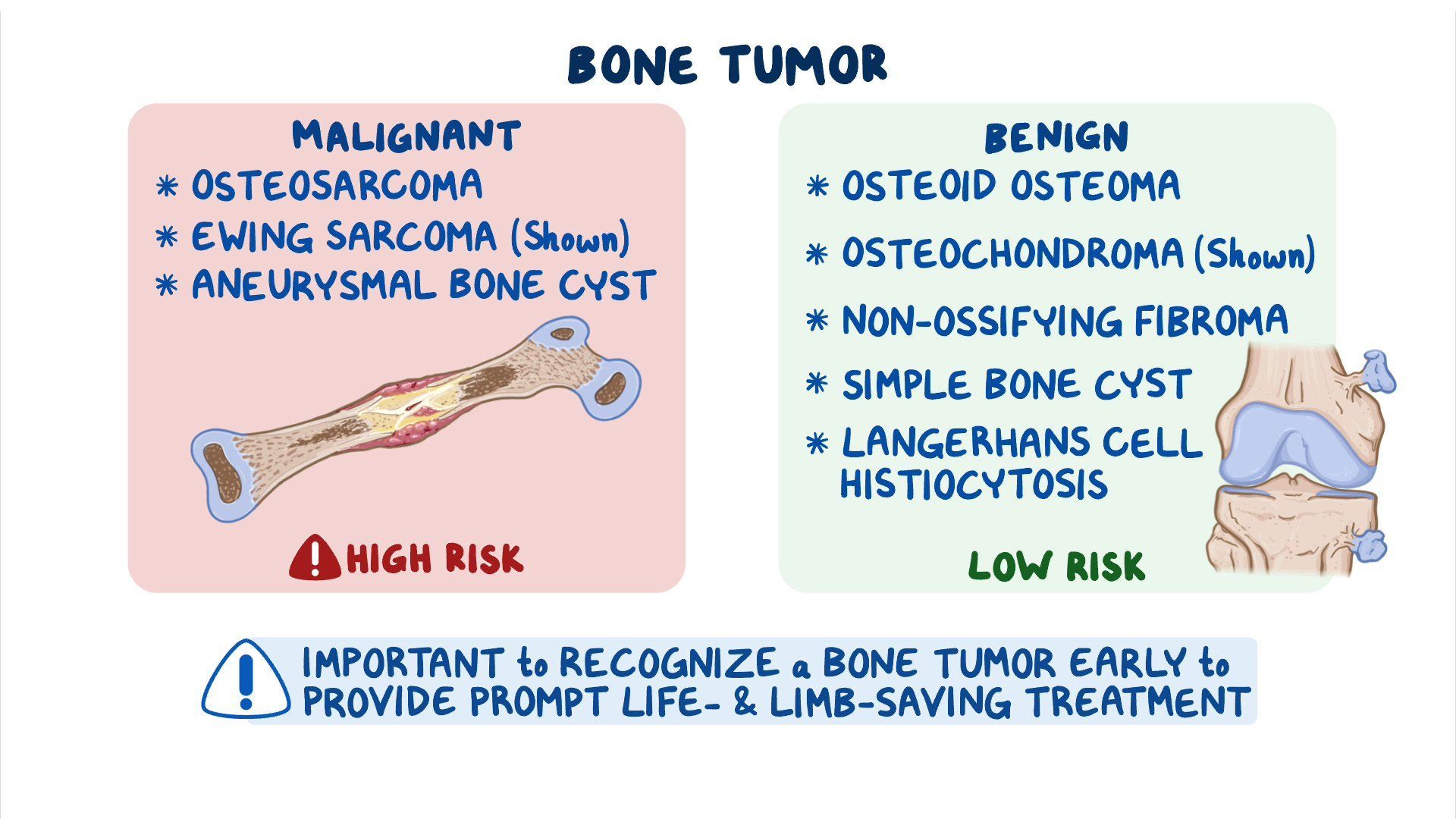 Video: Approach to a suspected bone tumor (pediatrics): Clinical sciences