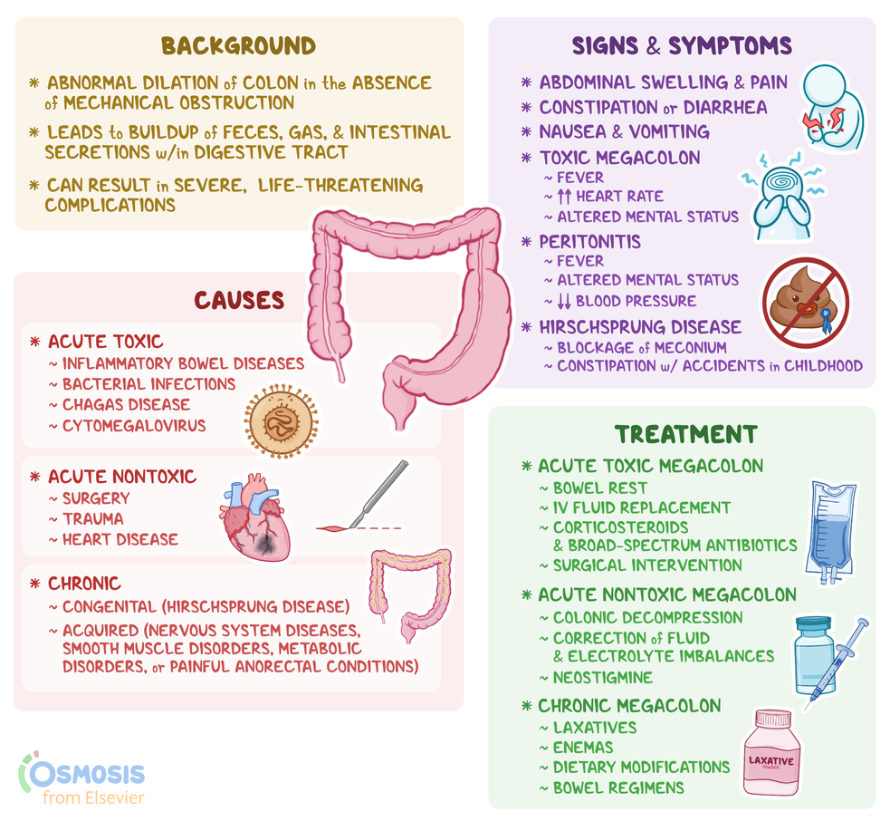 Megacolon: What It Is, Causes, Treatment, and More | Osmosis