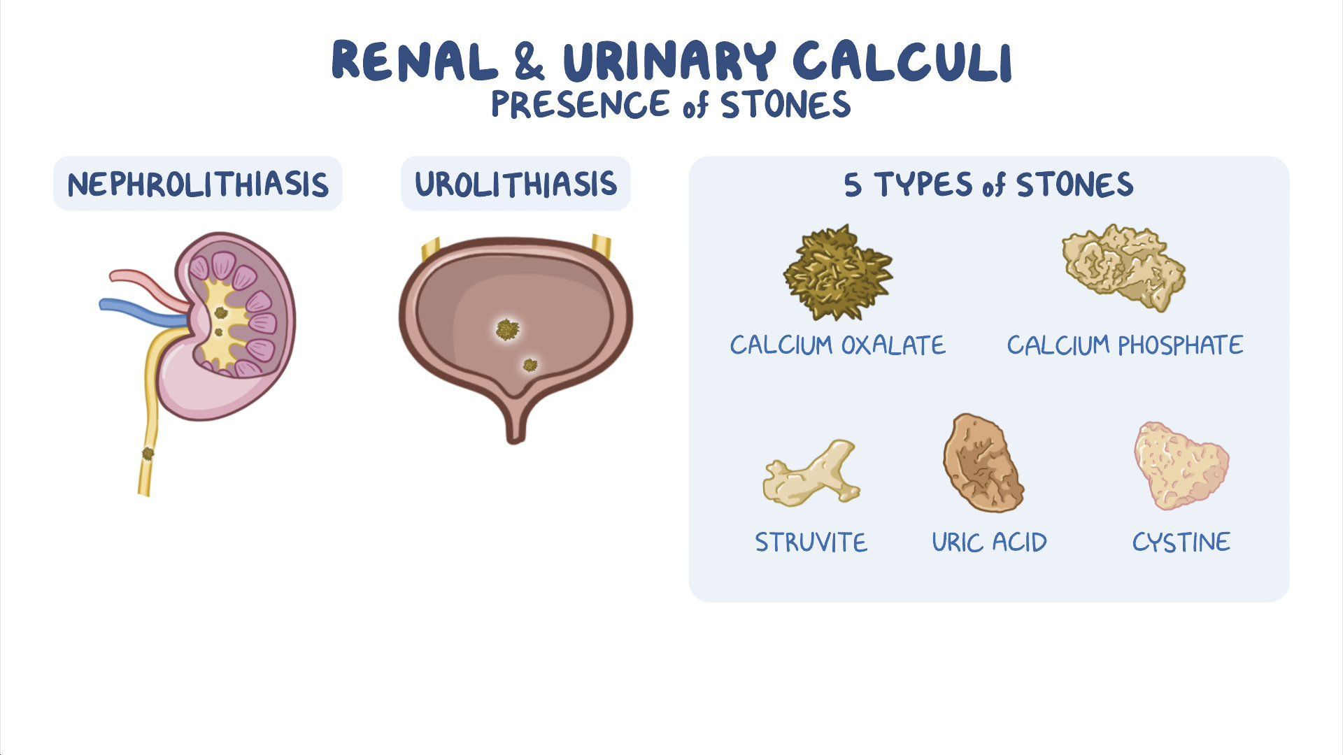 Video Renal And Urinary Calculi Nursing Osmosis