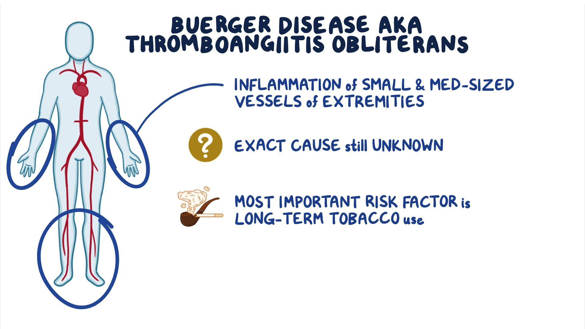 Video: Buerger disease: Year of the Zebra | Osmosis