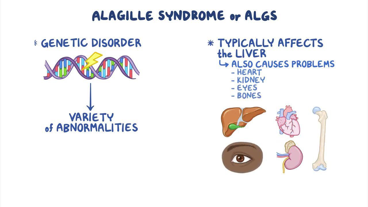 Alagille syndrome (NORD) - Osmosis