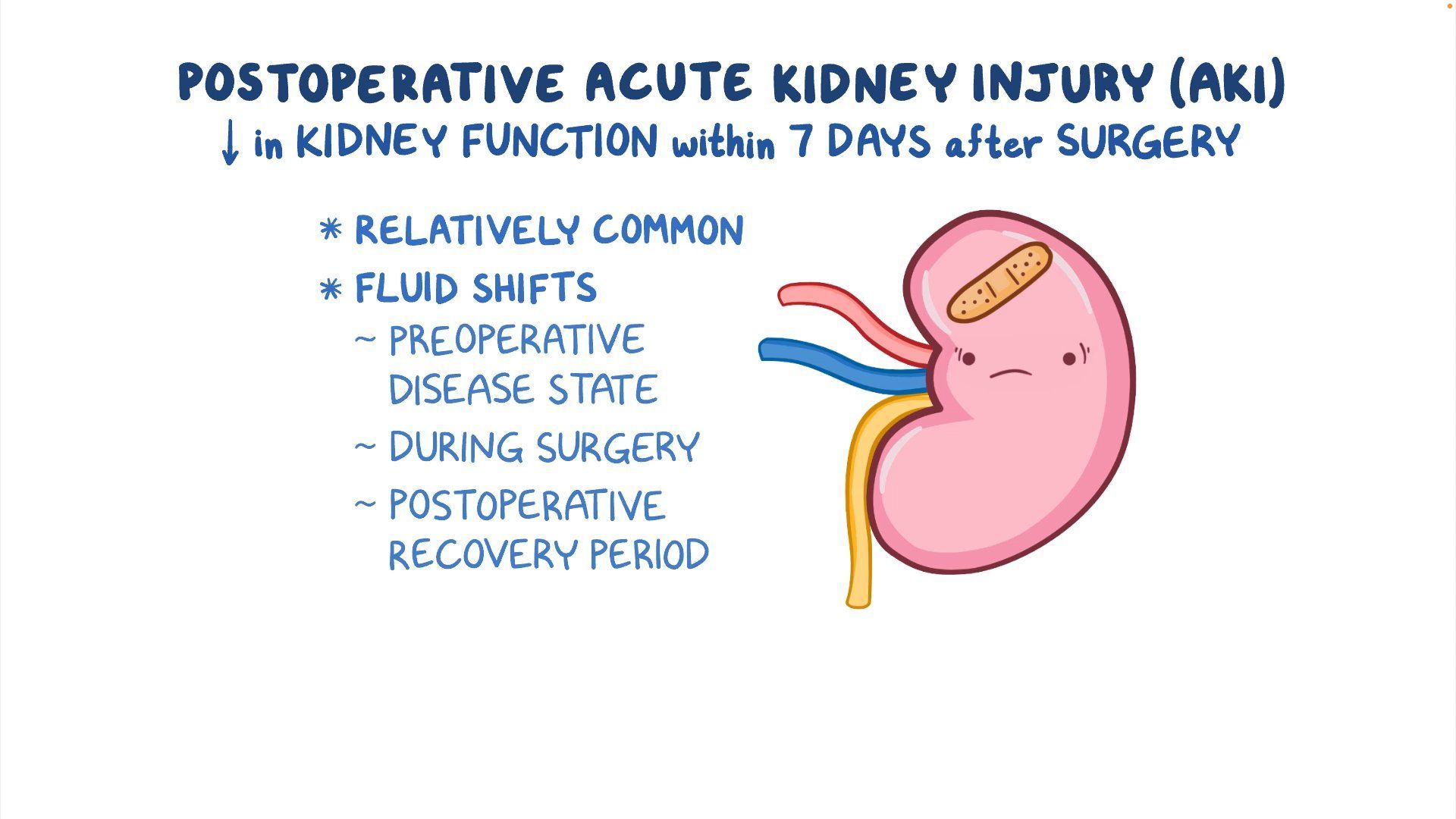 Video: Approach to postoperative acute kidney injury: Clinical sciences ...