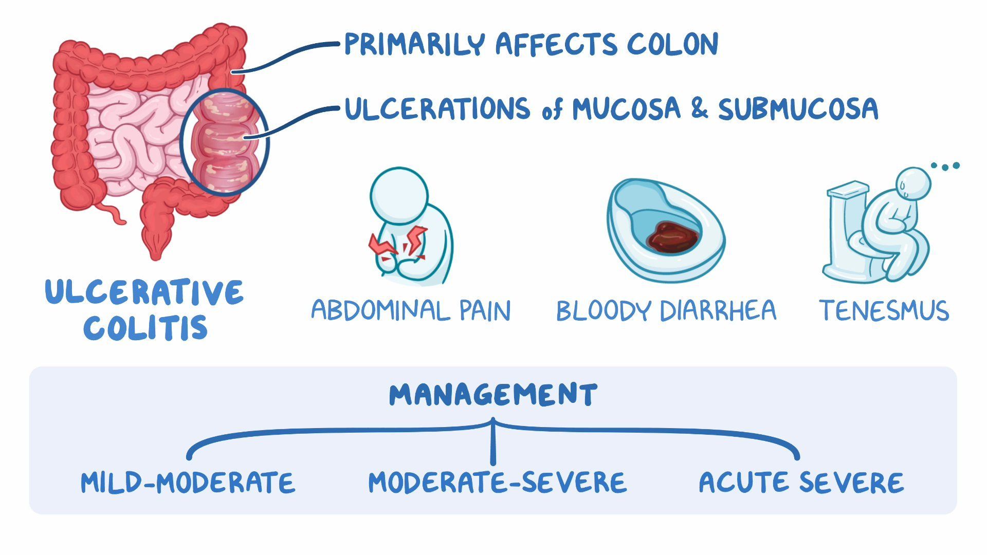 Ulcerative Colitis Diagnosis