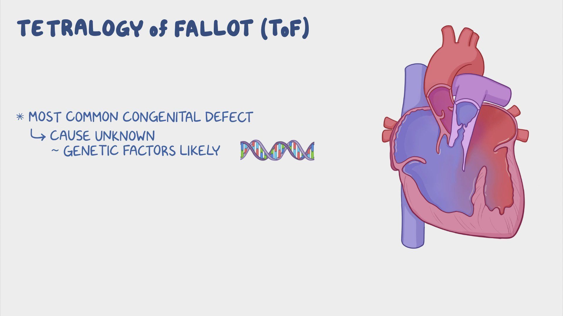 Video: Tetralogy of Fallot: Nursing | Osmosis