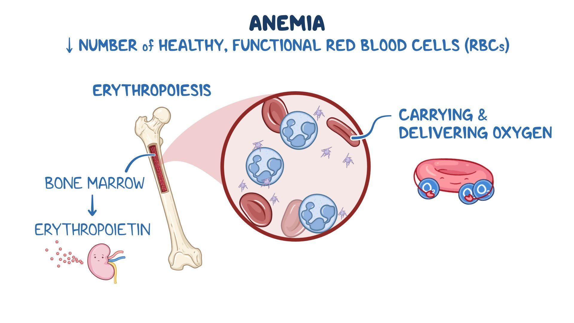 Video: Anemia: Nursing pathophysiology | Osmosis