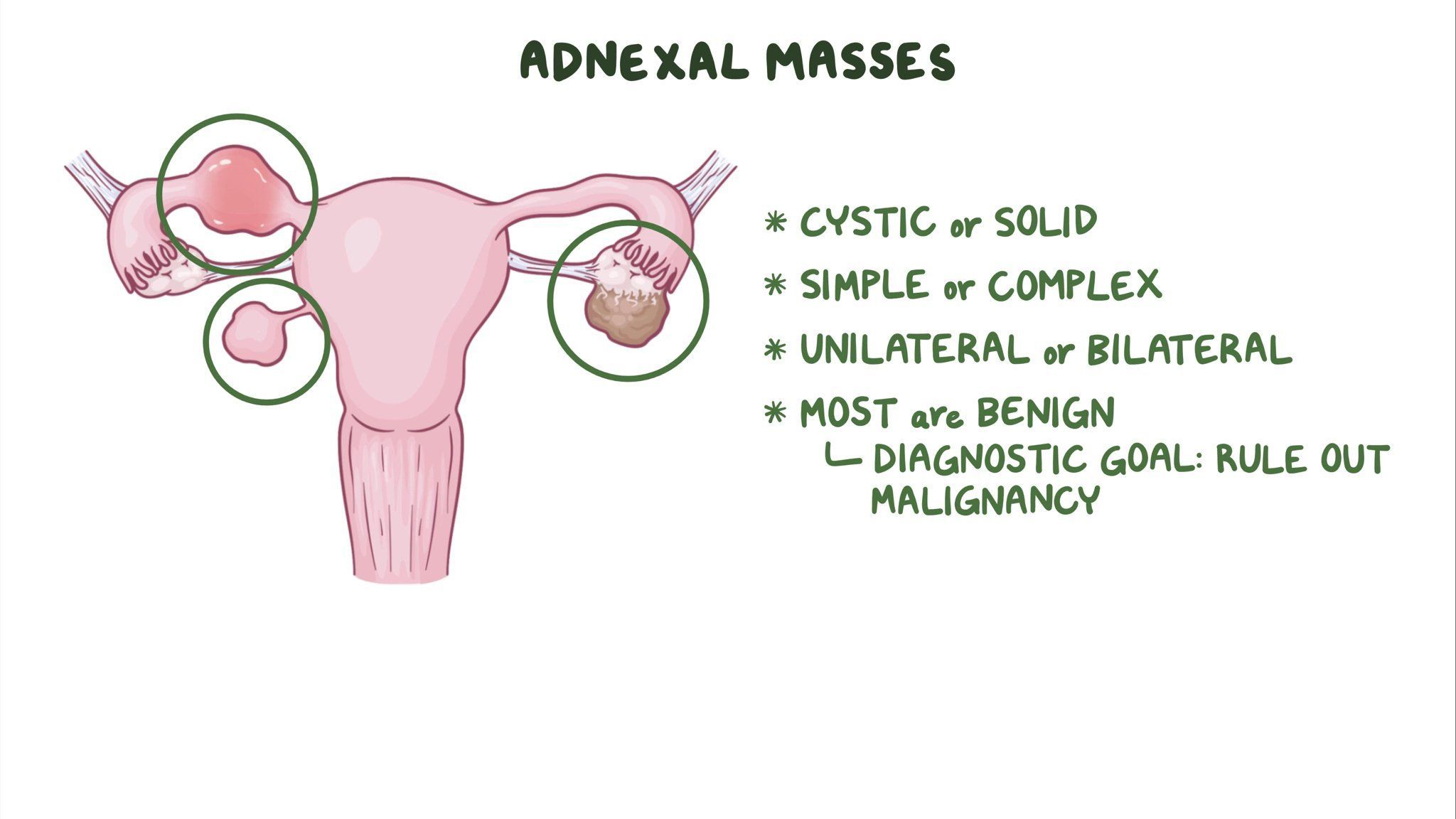 Video Approach To Adnexal Masses Clinical Sciences Osmosis Video Approach To Adnexal Masses Clinical Sciences Osmosis