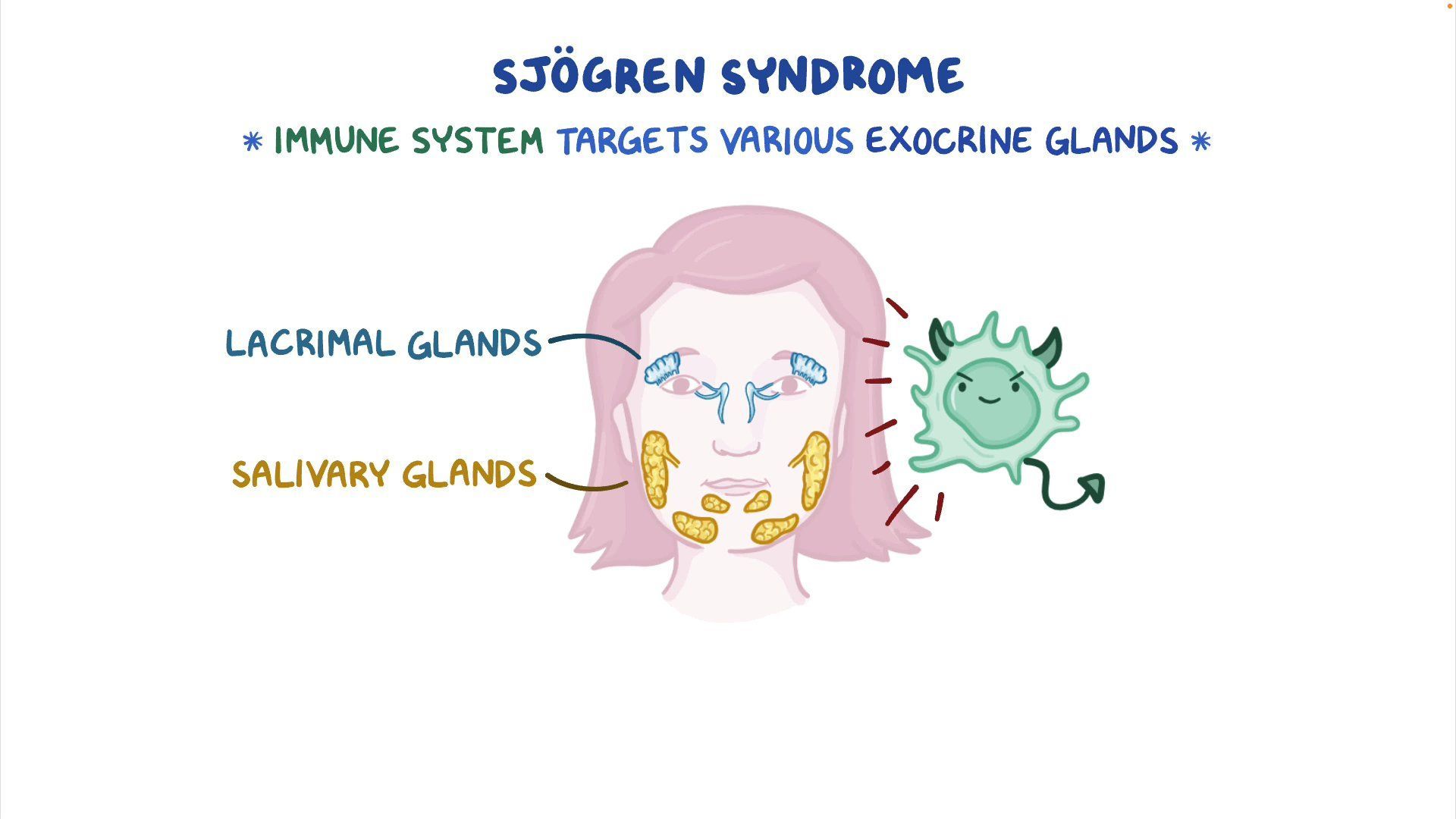 Video: Sjögren syndrome: Nursing | Osmosis