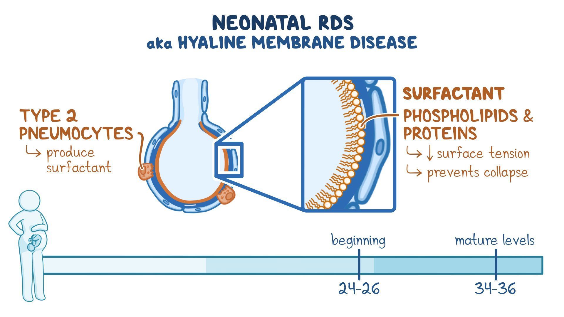 Video: Neonatal respiratory distress syndrome: Clinical sciences | Osmosis