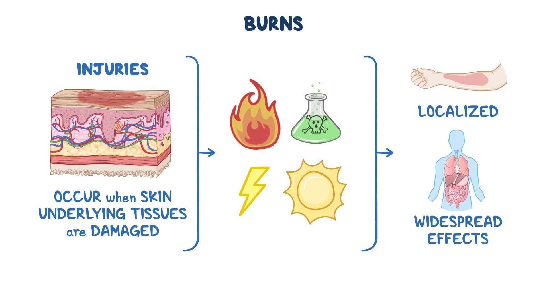 Video: Burns: Nursing pathophysiology | Osmosis