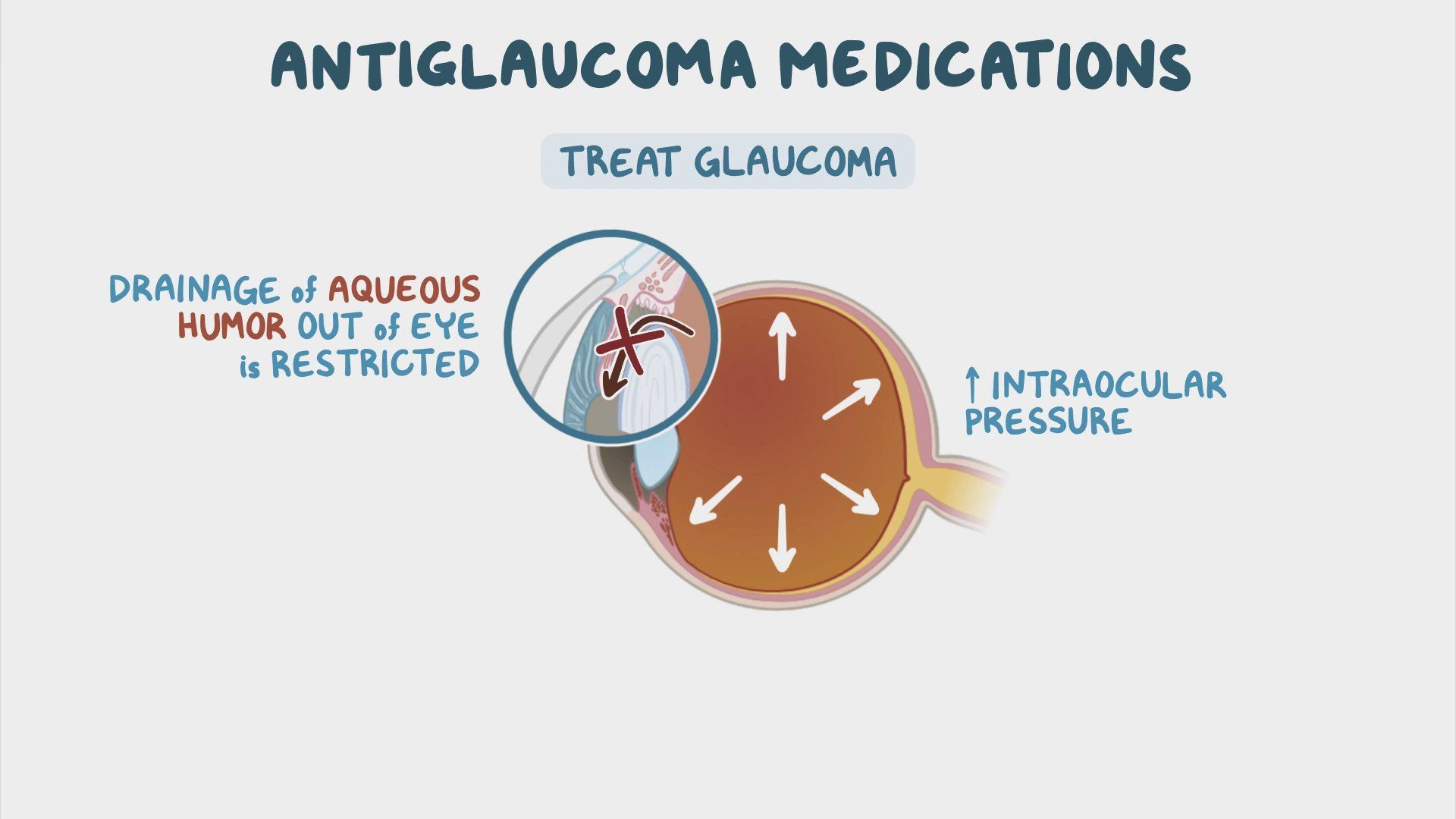 Video: Antiglaucoma medications: Nursing pharmacology | Osmosis