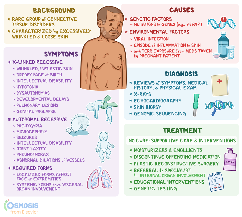 Cutis Laxa: What It Is, Causes, Signs and Symptoms, Diagnosis | Osmosis