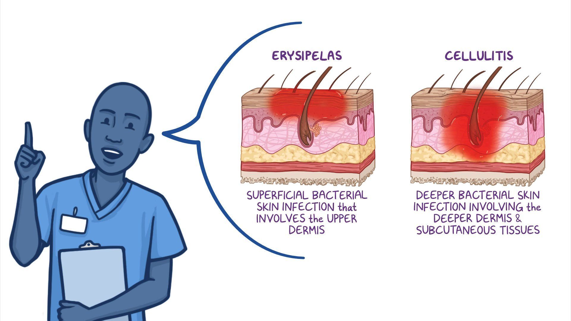 Erysipelas In History Erysipelas: Causes And Treatment | Dermatology