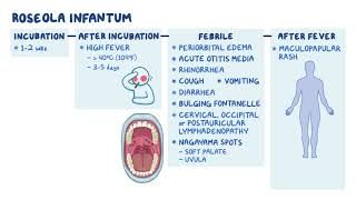 Video poster for Human herpesvirus 6 (Roseola)