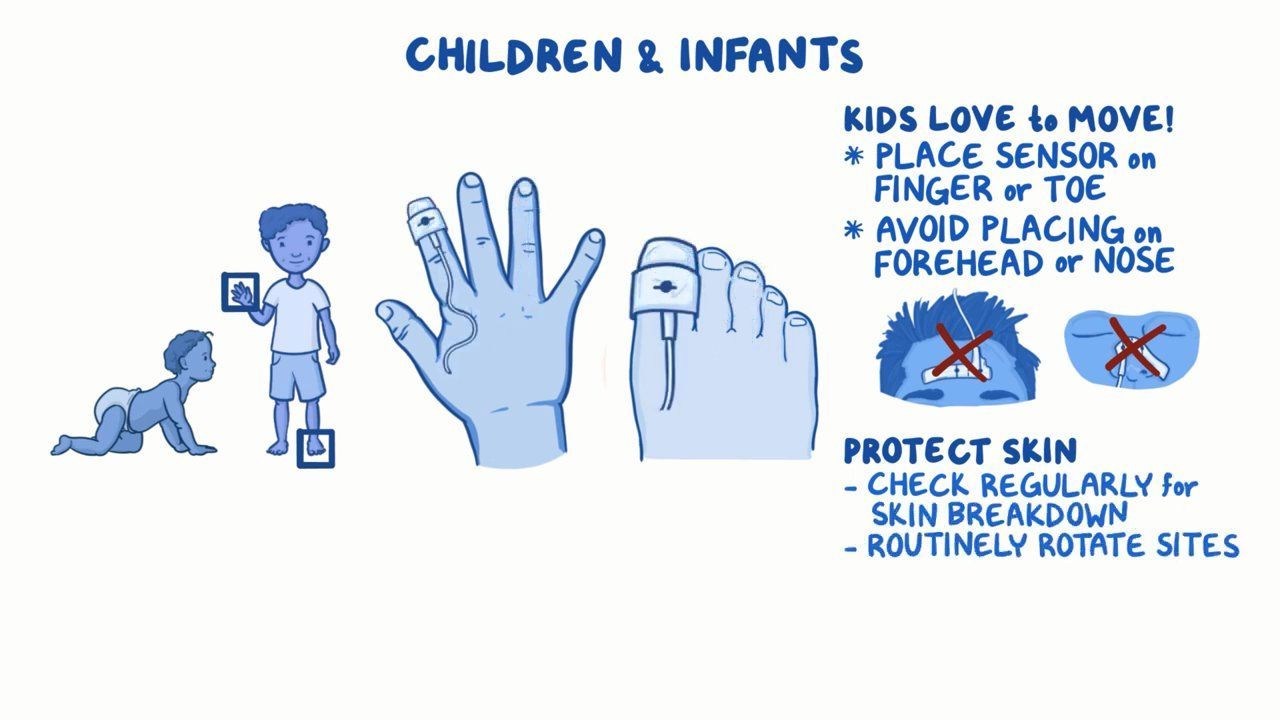 Video: Clinical Skills: Pulse oximetry | Osmosis