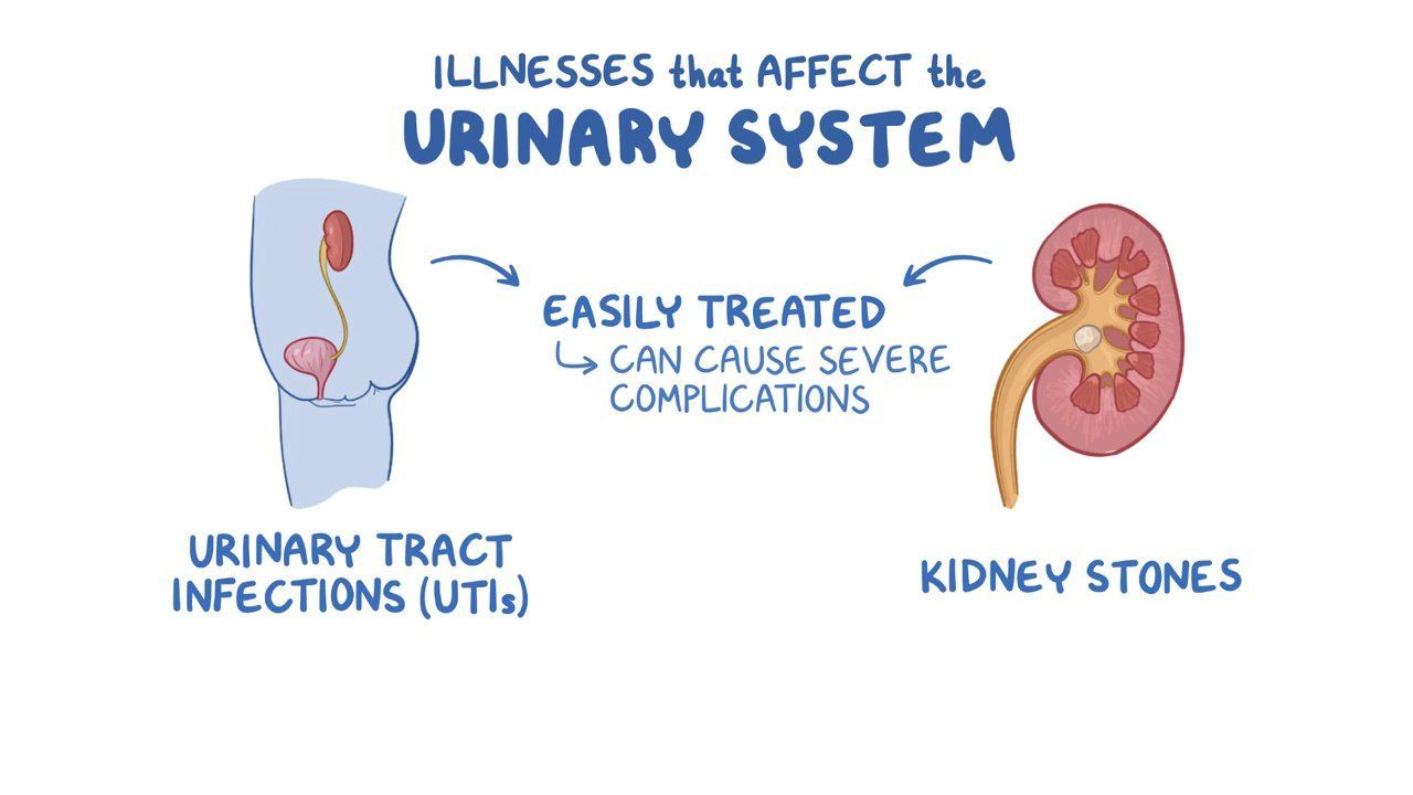 Video: Urinary system: Infections and stones | Osmosis