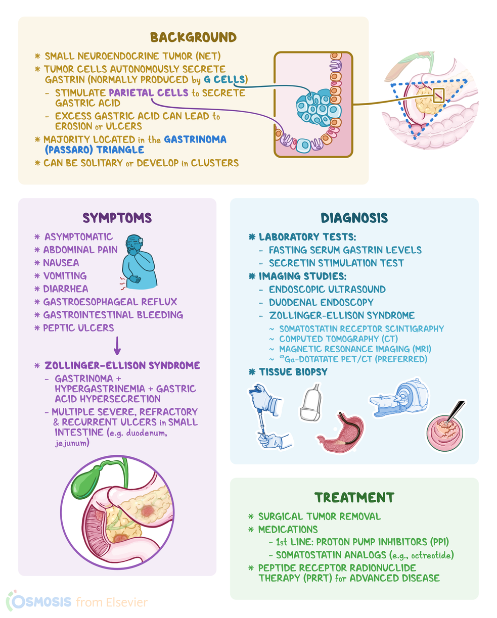 Gastrinoma: What Is It, Symptoms, Diagnosis, Treatment, and More | Osmosis