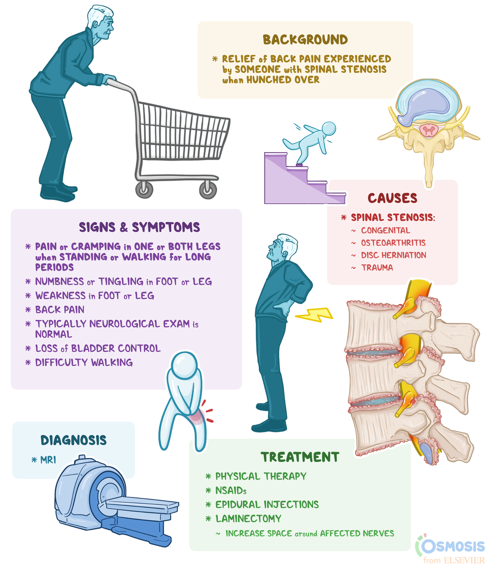 Shopping Cart Sign What Is It What It Means And More Osmosis