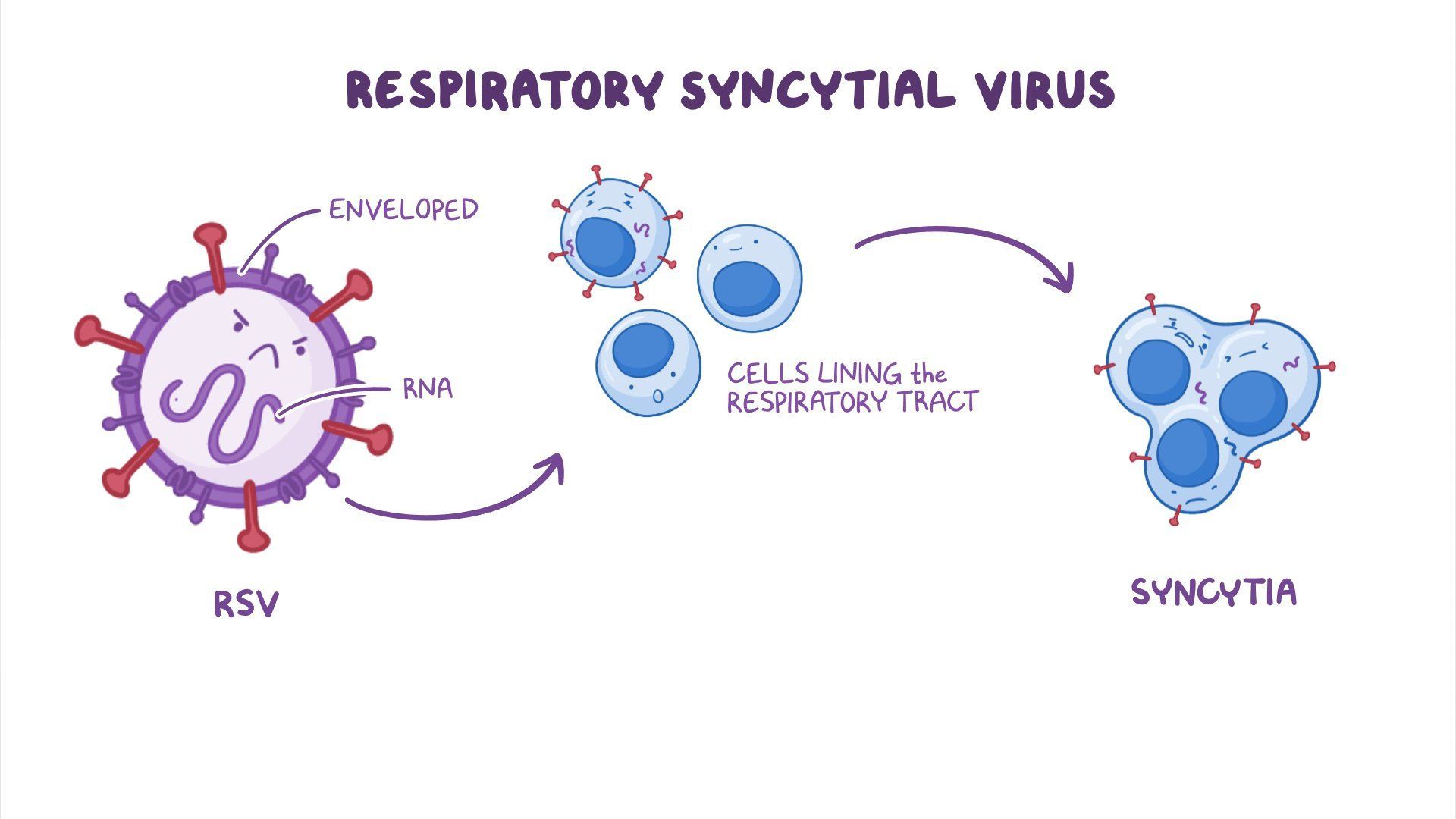 Video: Medications for respiratory syncytial virus (RSV): Nursing ...