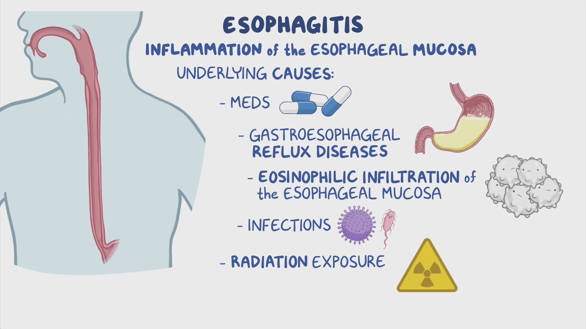 Video: Esophagitis: Clinical sciences
