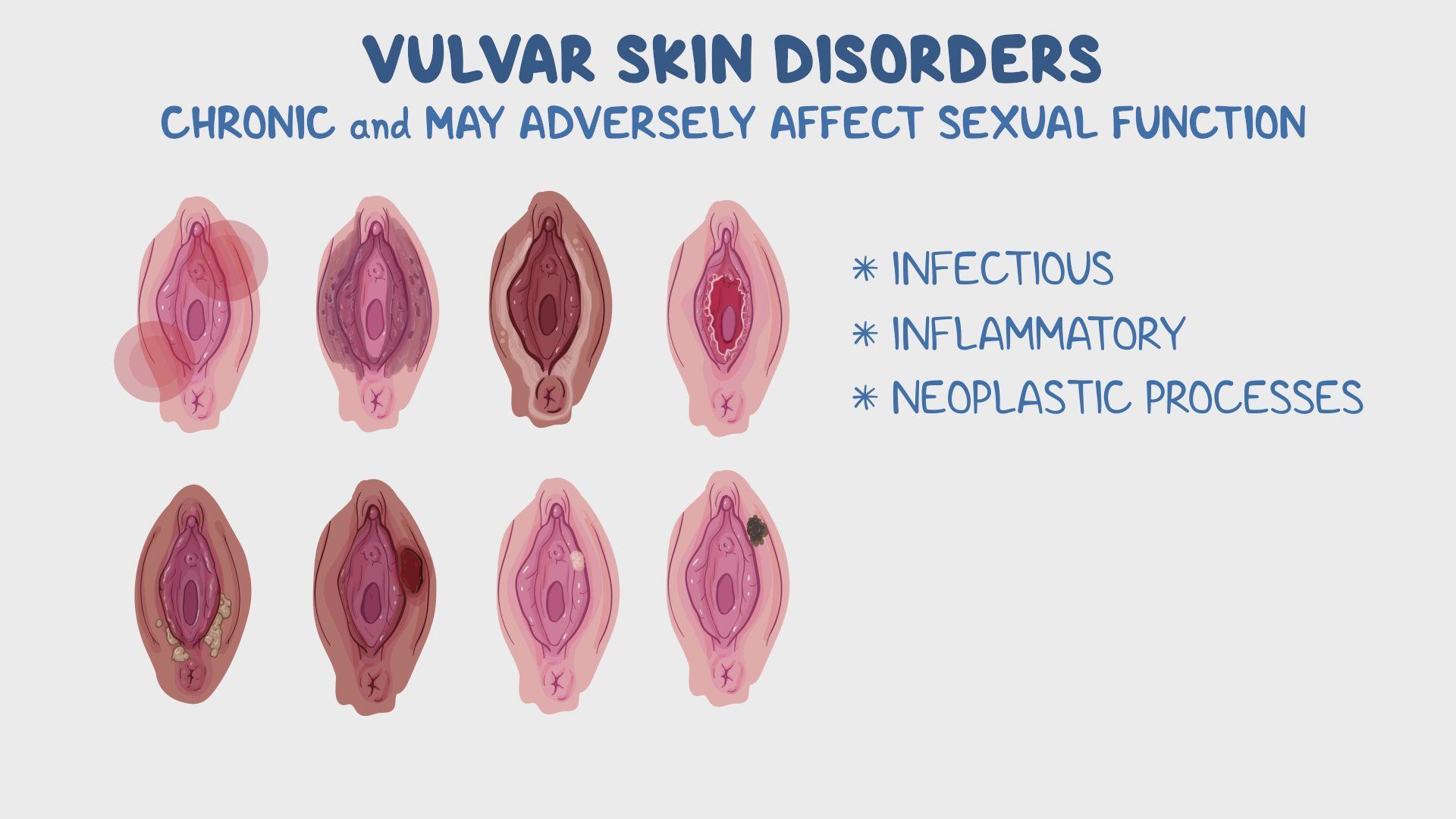 Video: Approach to vulvar skin disorders: Clinical sciences | Osmosis