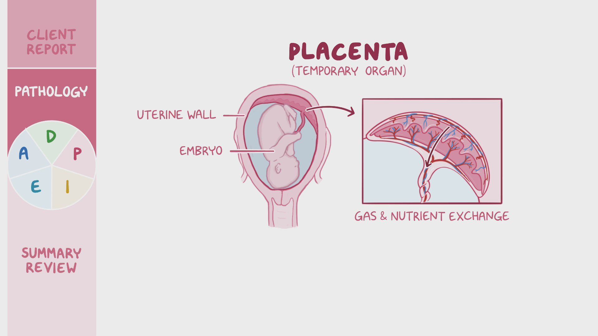 Video: Placental abruption: Nursing process (ADPIE) | Osmosis