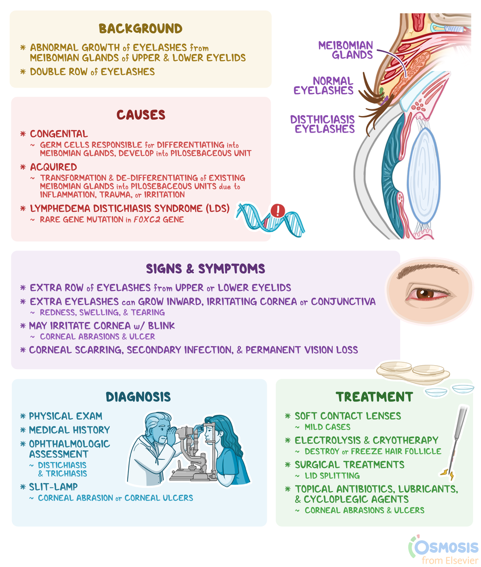Distichiasis: What It Is, Causes, Diagnosis, and More | Osmosis