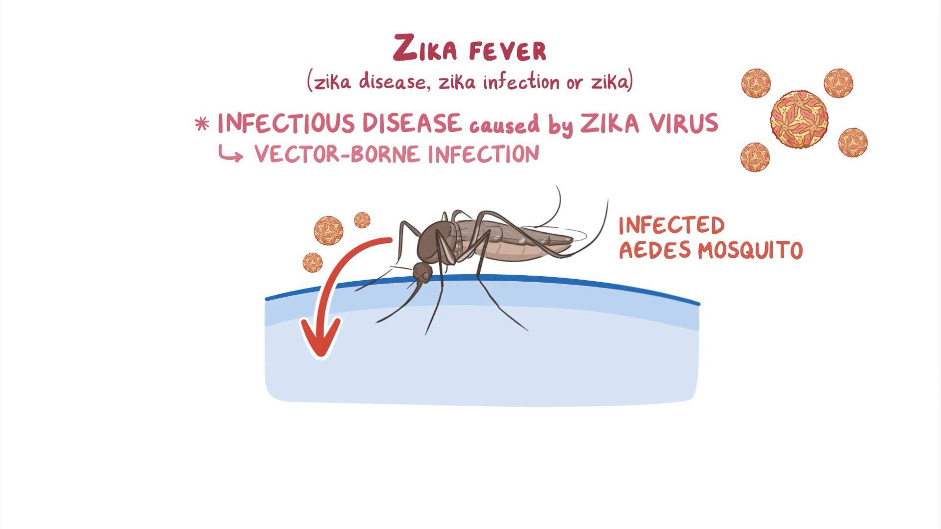 Video: Zika virus: Nursing | Osmosis