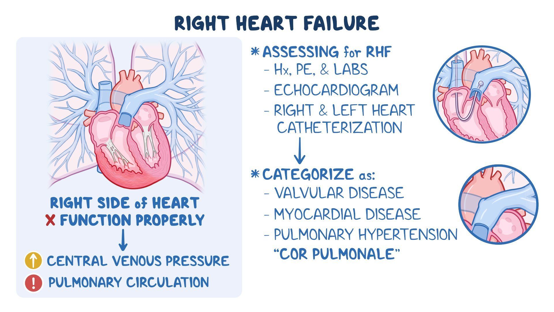 Video: Right heart failure (cor pulmonale): Clinical sciences | Osmosis