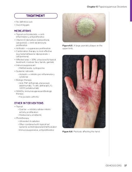 Lichen Planus On Wrist